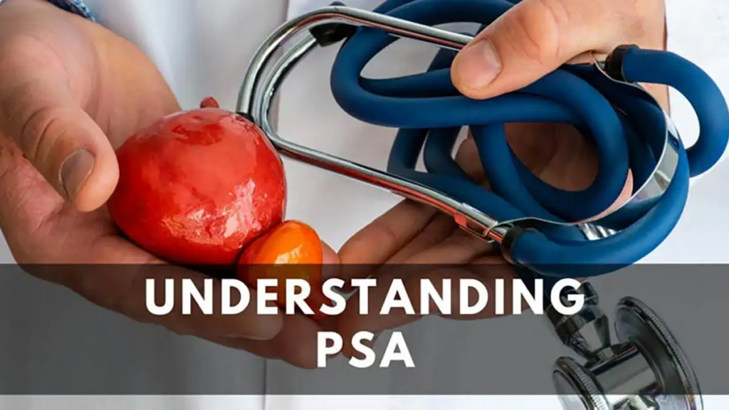 Deciphering PSA Levels Understanding Their Significance In Prostate